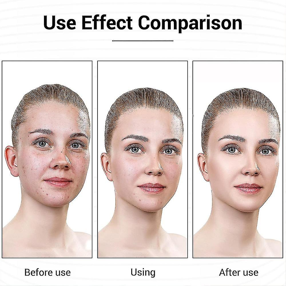 Led Face Mask Light Therapy, 7 Led Light Therapy For Facial - Blue ...