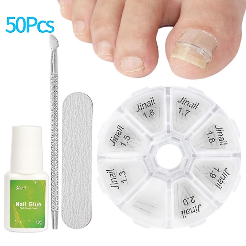 Ingrown Toenail Tool Straightening Clip Curved Brace Paronychia ...