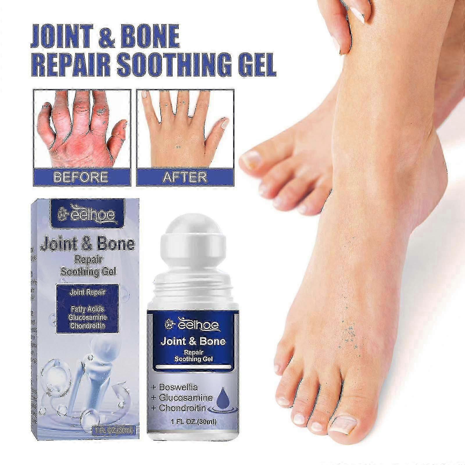Joint Care Gel To Relieve Pain Of Wrist, Knee, Lumbar Spine, Muscles ...