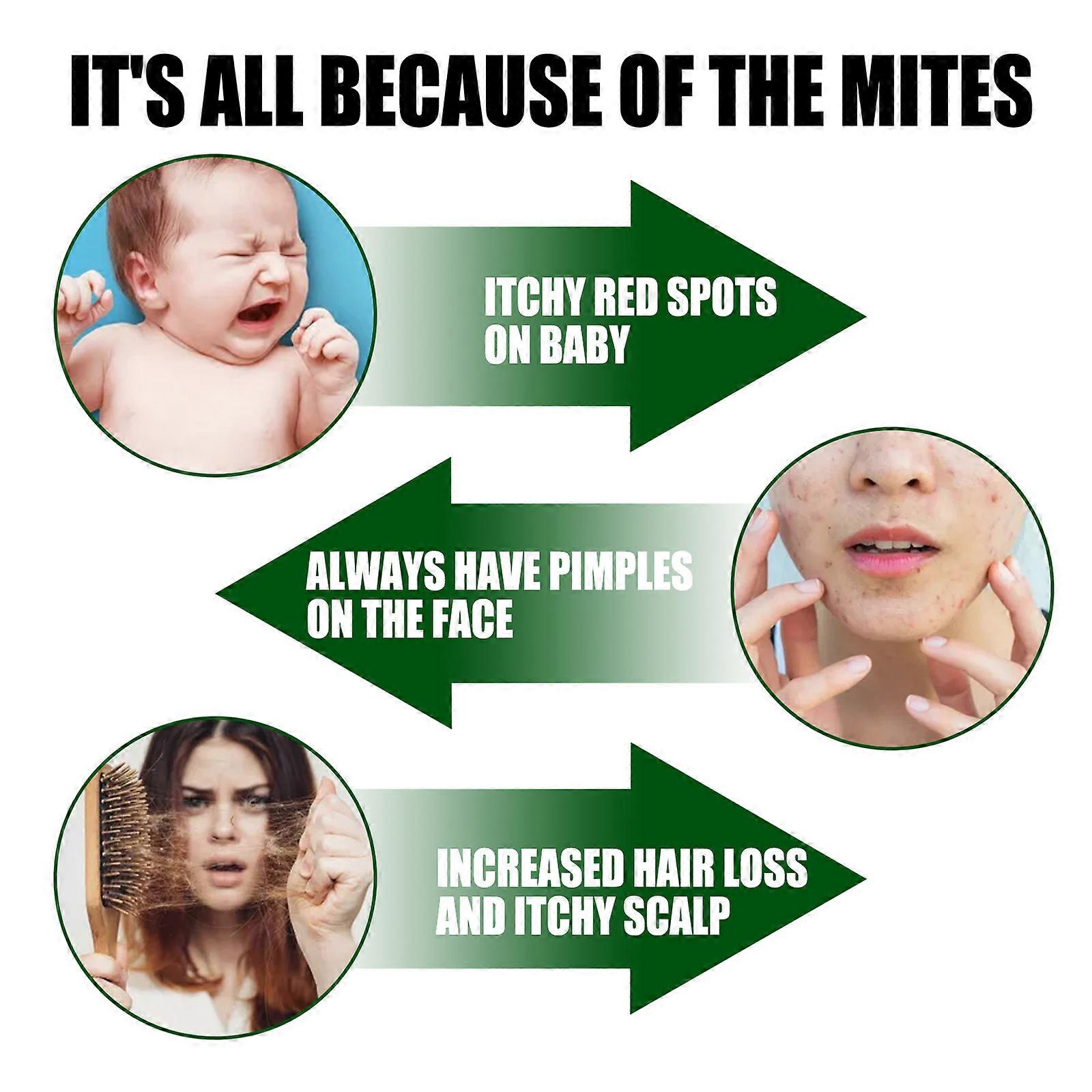 3x Bed Bug And Dust Mite Killer Natural Spray Treatment For Mattresses ...