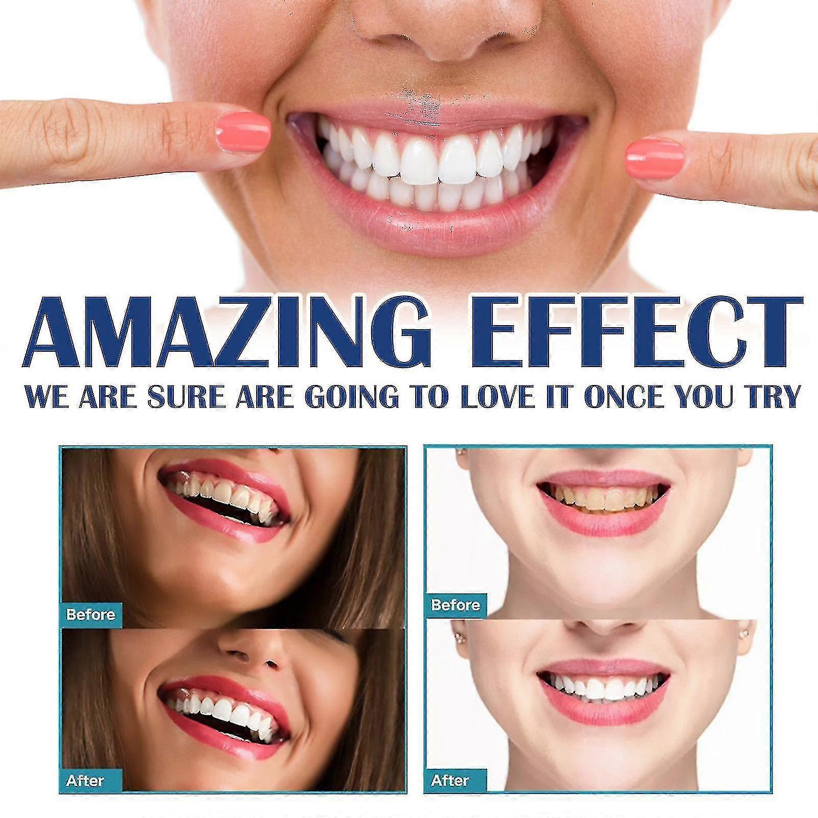 Jaysuing Of Teeth Whitening Paint To Remove Tooth Stains, Tooth Dirt ...