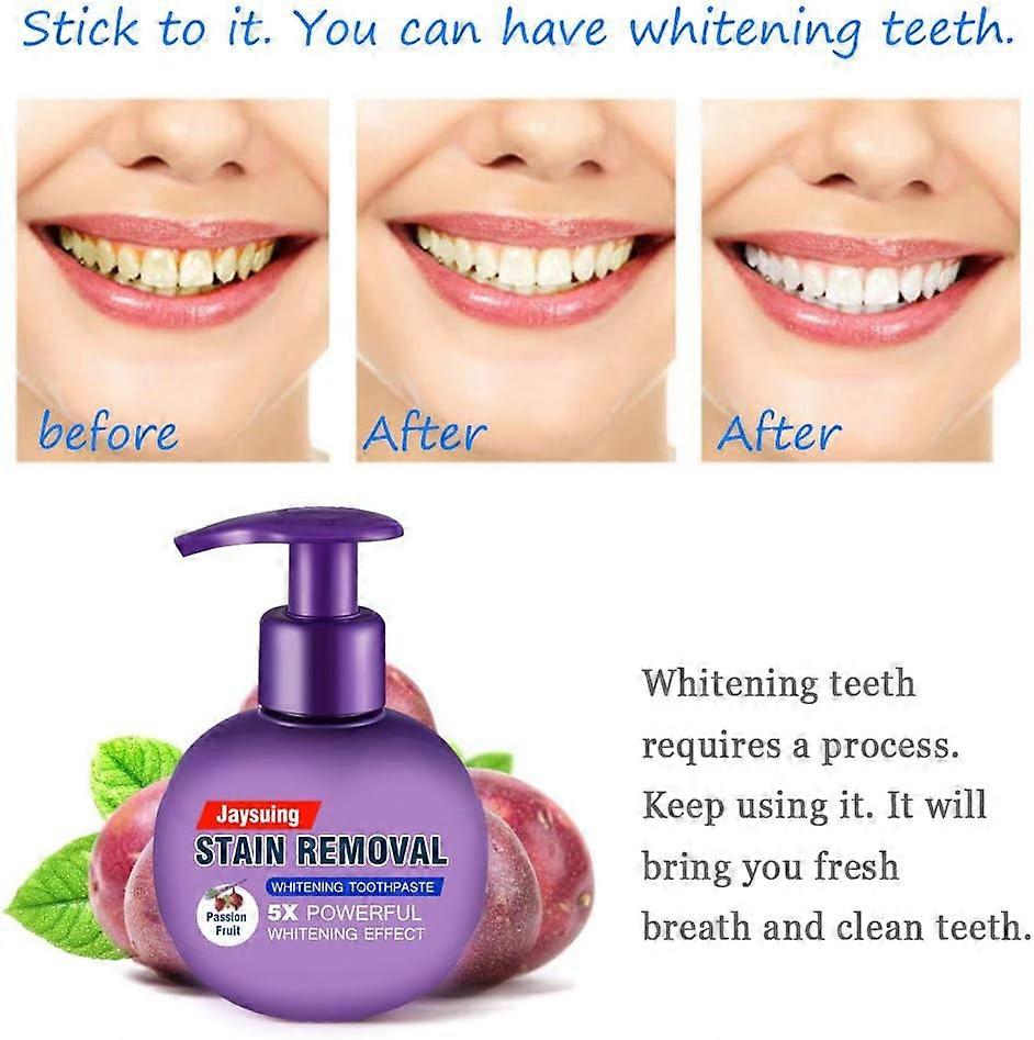 Whitening Toothpaste, Baking Soda Press Toothpaste, Intensive Stain ...