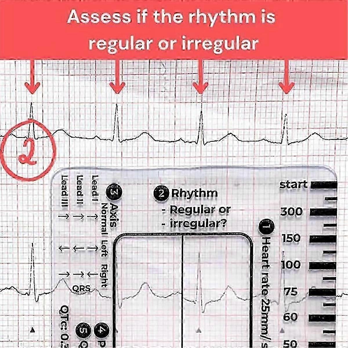 2-teiliges EKG-Lineal mit 7 Schritten, EKG-Lineal mit 7 Schritten für ...