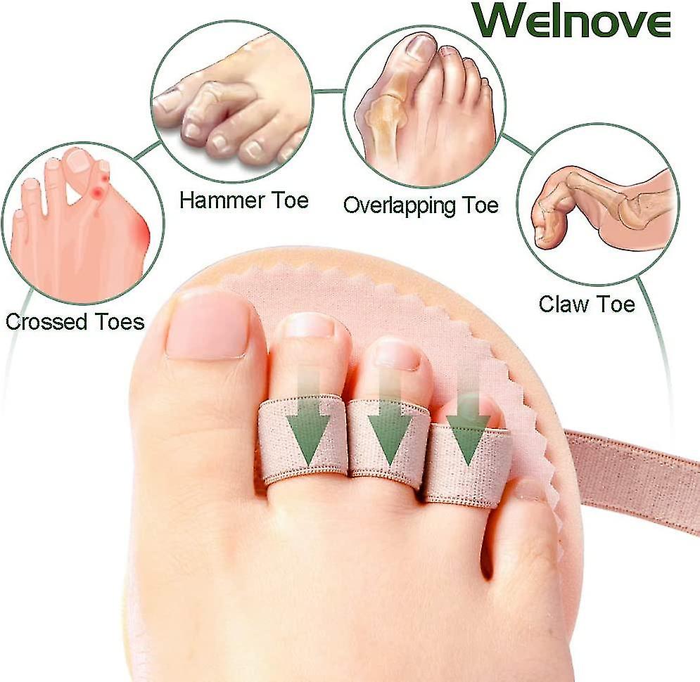 Tårätare Hammer Toes Corrector Pack med 2 (3 hål) För Claw Toe Mallet ...