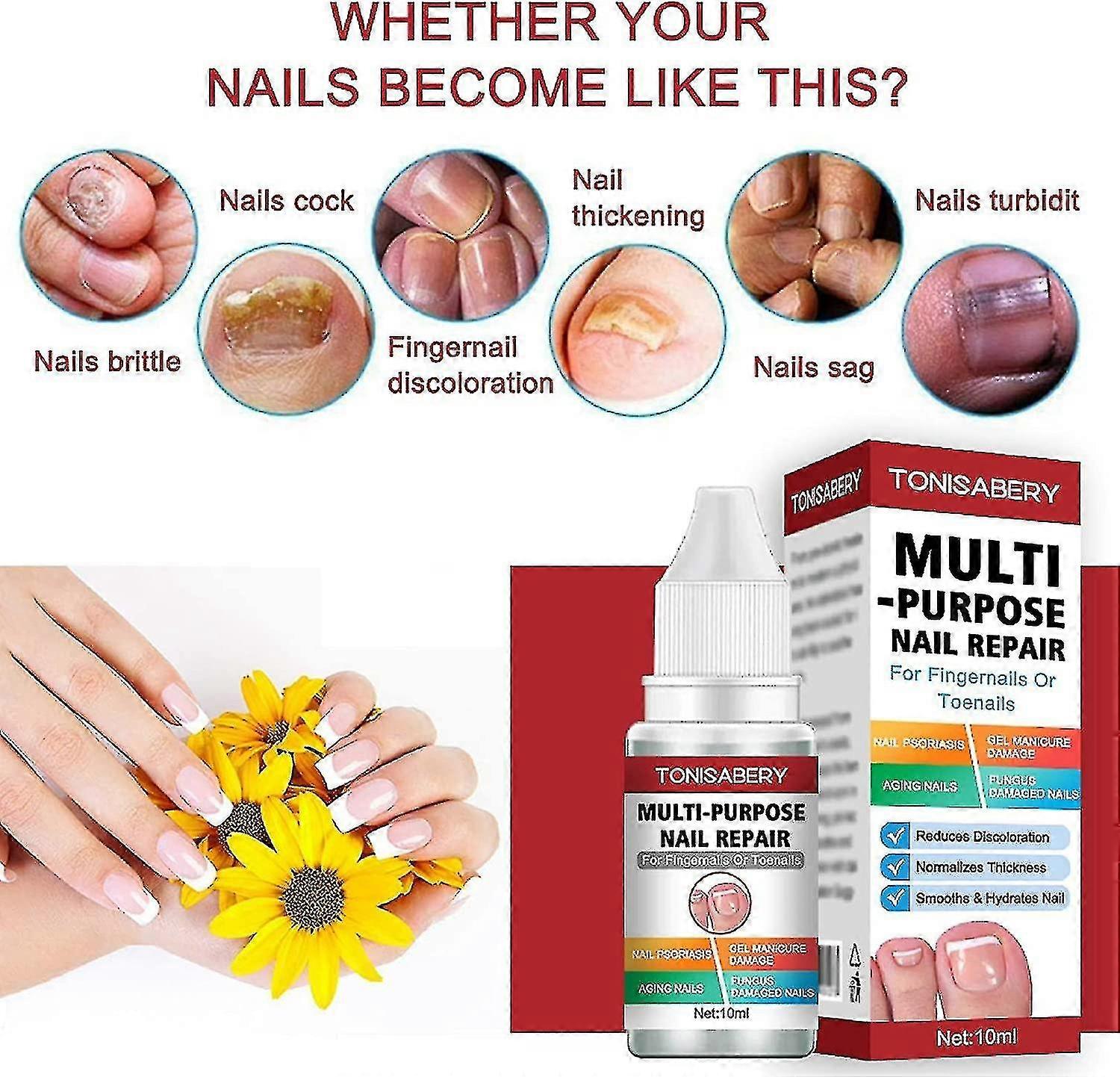 Fungal Nail Treatment For Toenails Extra Strong,nail Fungus Treatment For Toenail,toenail Fungus ...