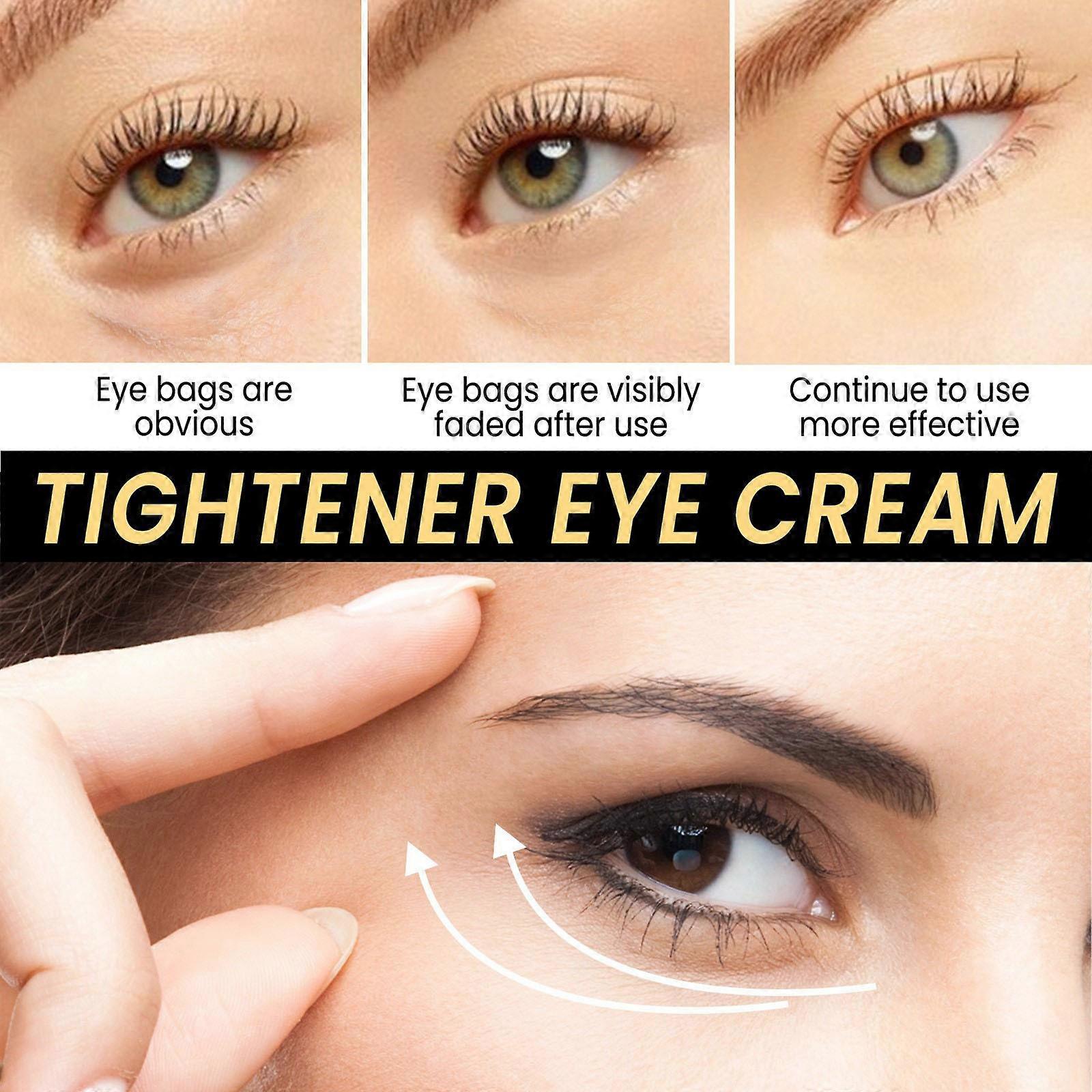 Firming Eye Cream Lightens Eye Bags Periorbital Dark Circles Fine Lines ...