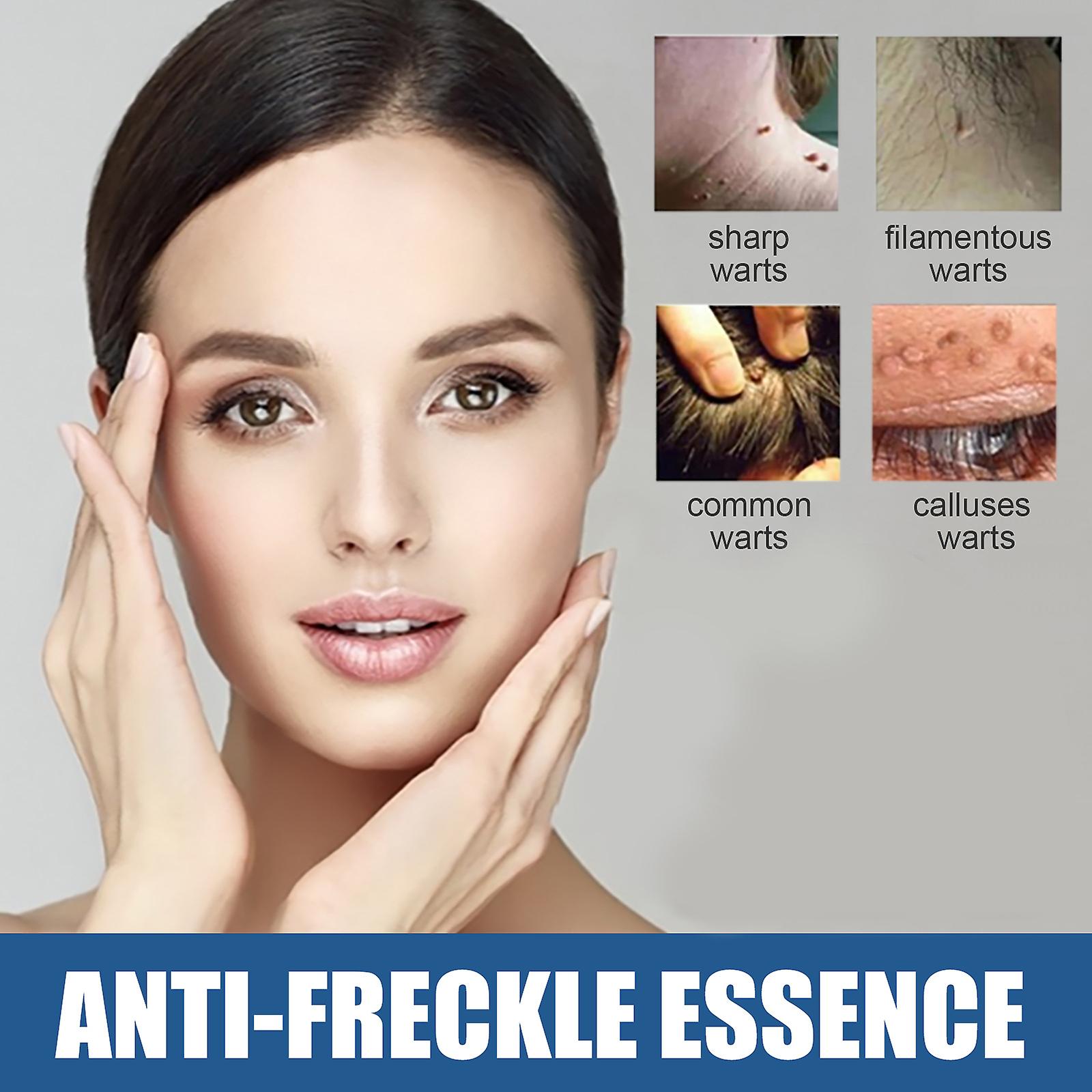 Qian Eelhoe Peau Nettoyage Gram Verrue Keyou Liquide Corps Visage ...