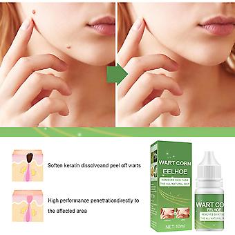 Mole Elimination Potion Skin Removal Of Black Spots Fades Melanin ...