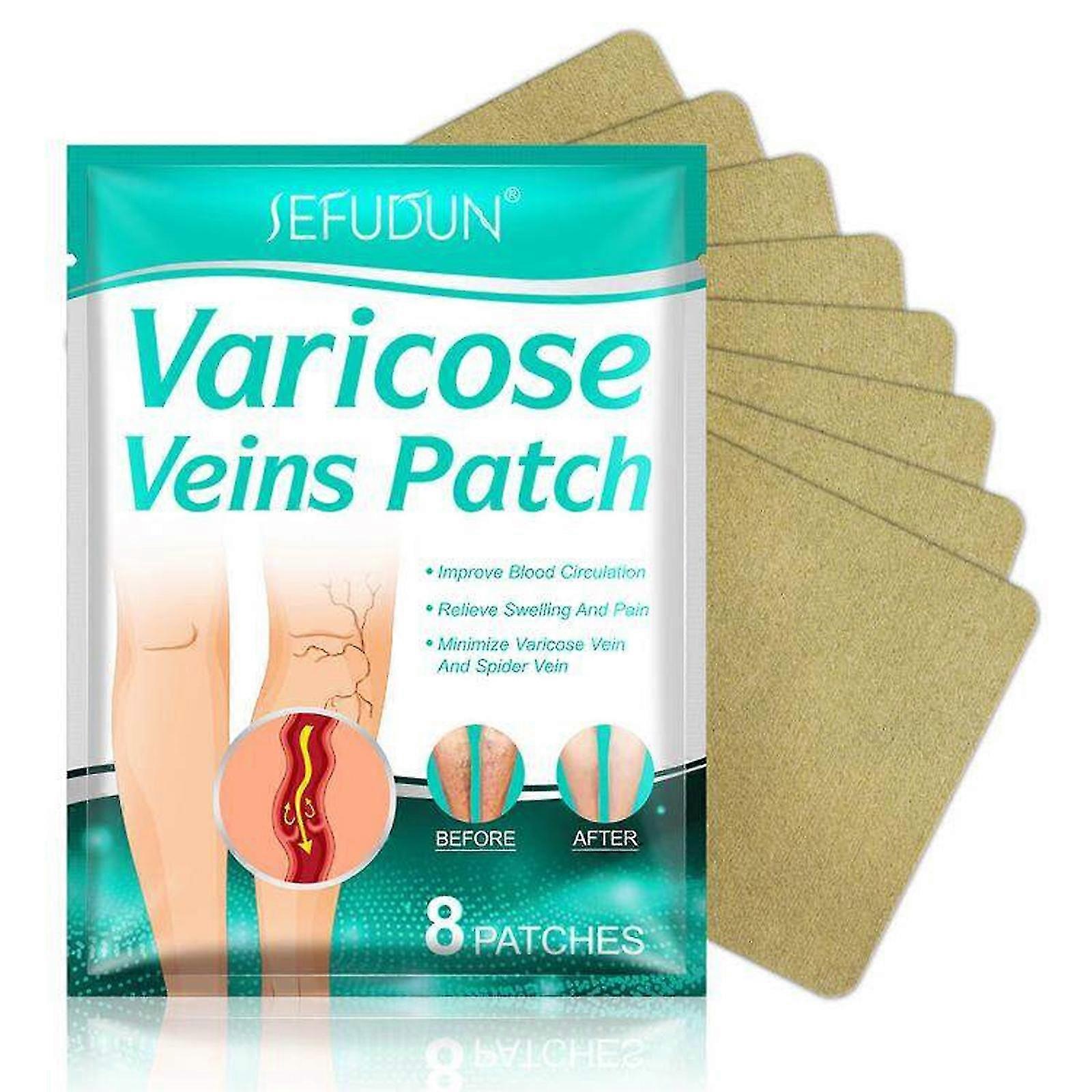 Varicose Veins Patch Relief Leg Vasculitis Spider Varicose Vein Patches ...