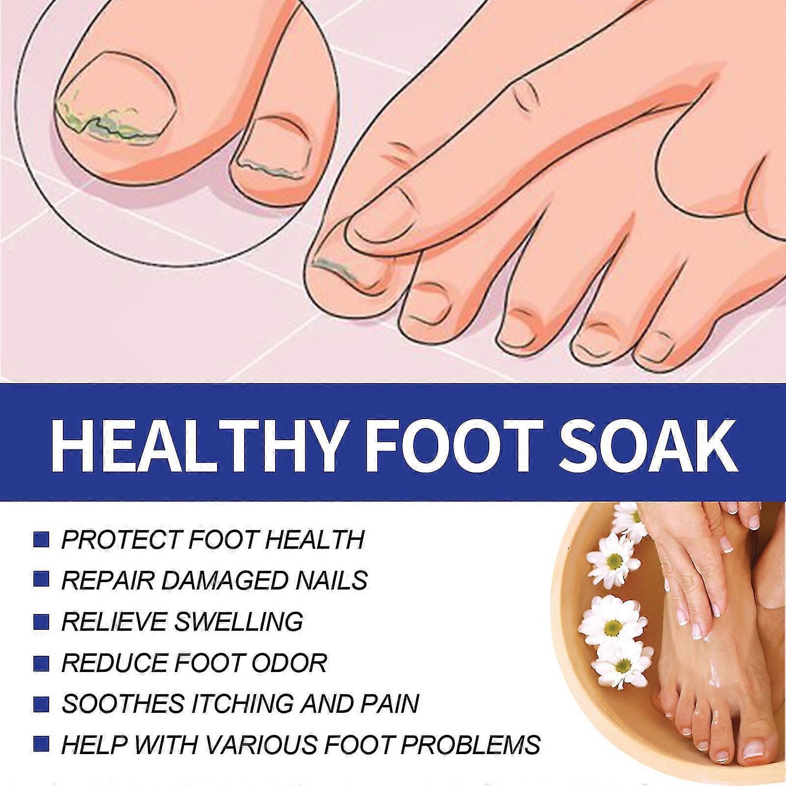 10pcs Foot Soak For Toenail Repair, Athletes Foot, Softens Calluses ...