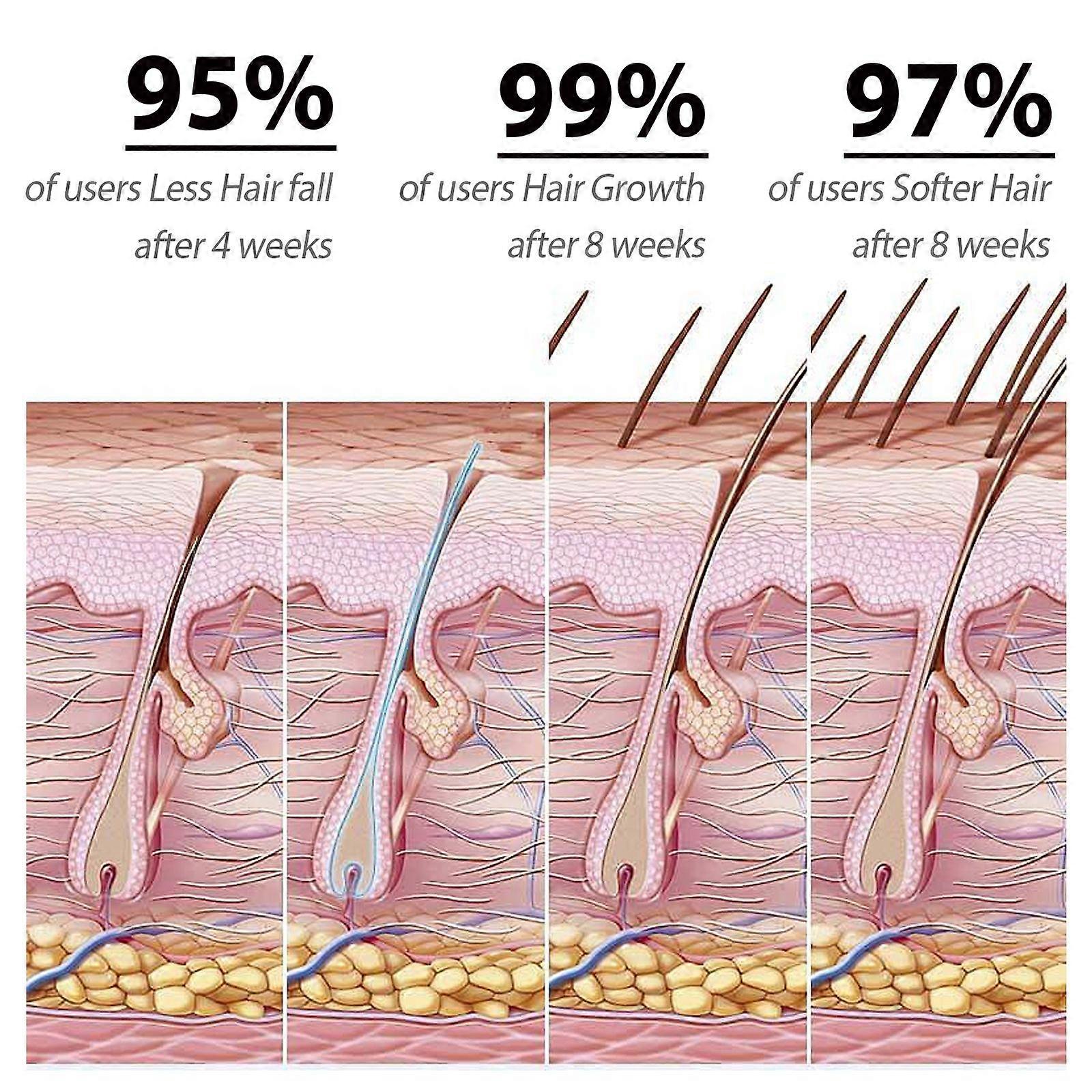 Amino Acid Shampoo, Deeply Clean The Scalp Repair Hair Follicle Damage ...