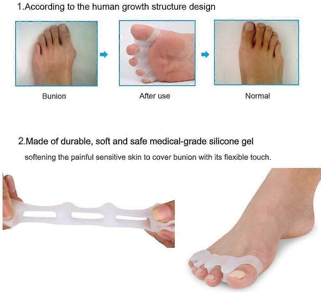 Toe Separators for Overlapping Toes, Gel Toe Straightener Bunion ...