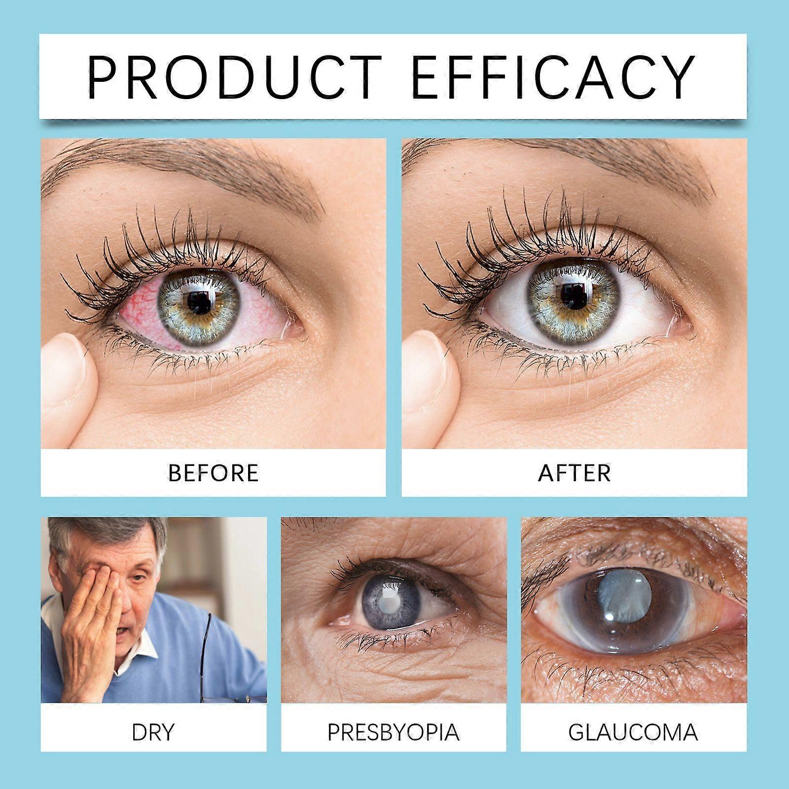 Presbyopia Vision Care Drops Removal Enhance Eyesight Cataract Cure Relief Eye Pain Blurred ...
