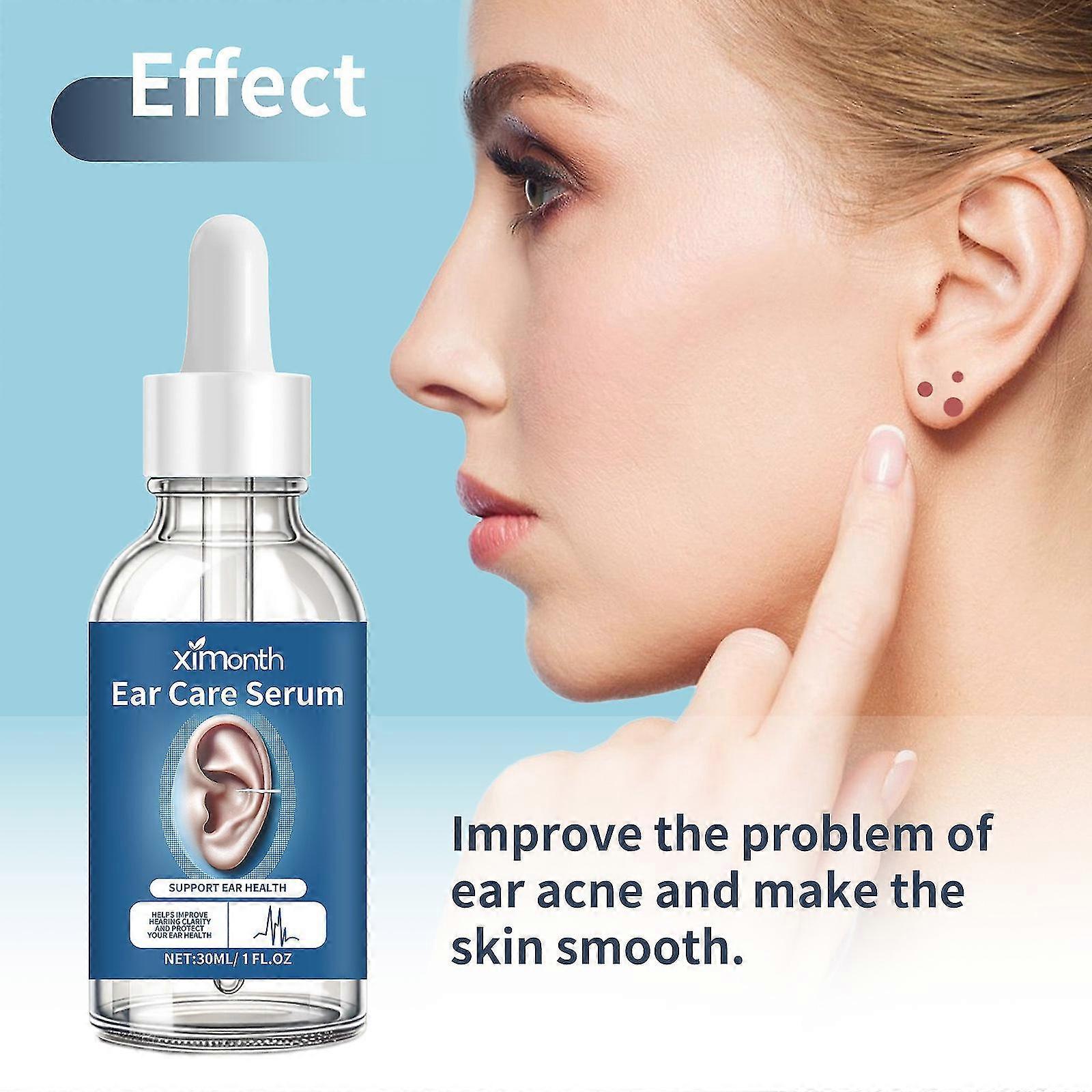 Ear Care Serum, Anti EarInfections and Tinnitus Relief Serum, Natural ...