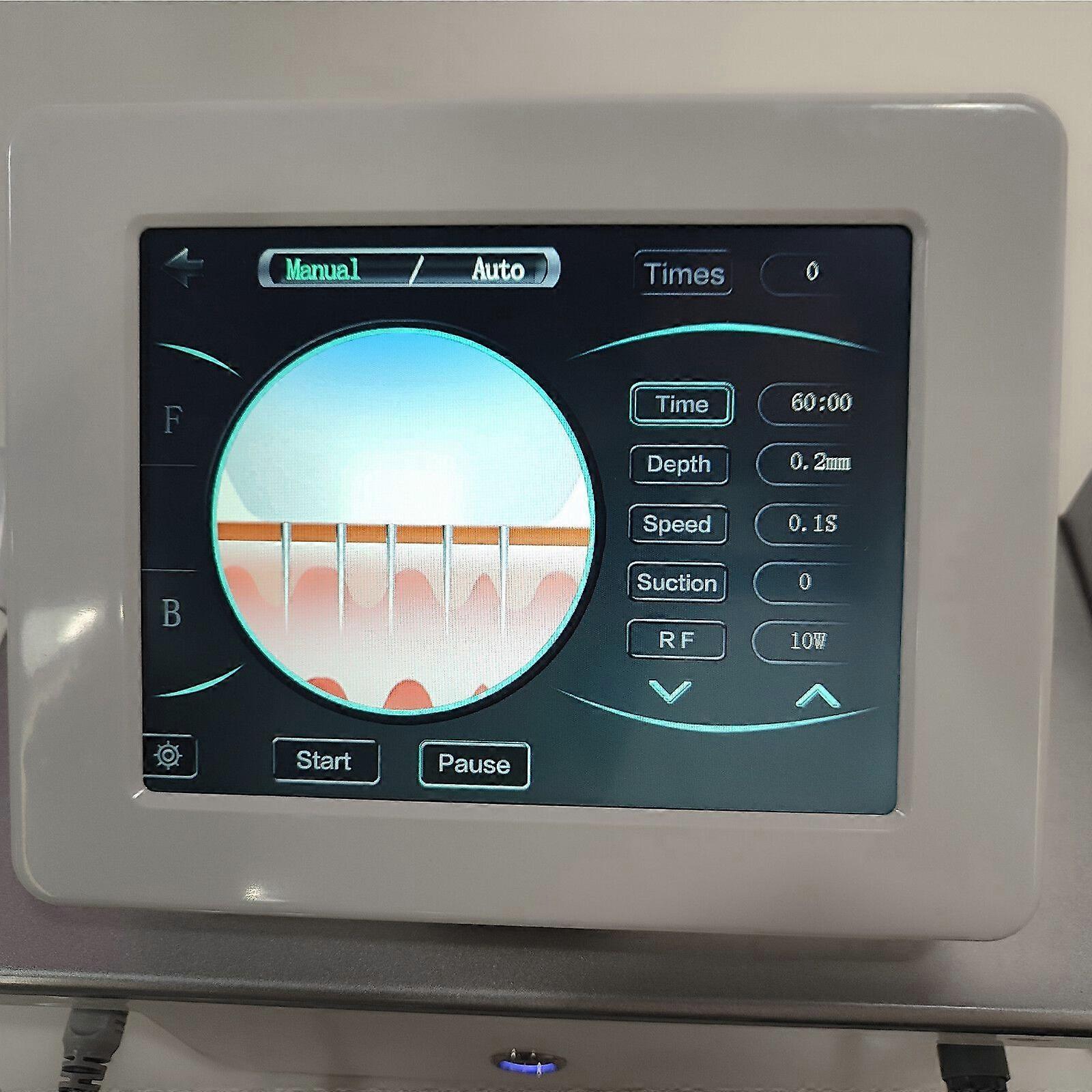 2in1 Fractional RF Micro-tip Machine Kalter Hammer Strecken Mark Akne ...