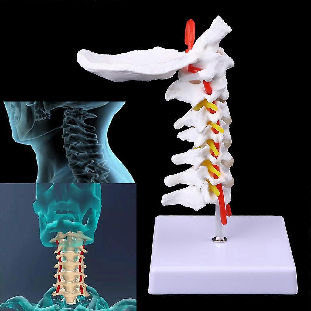 Cervical Vertebra Arteria Spine Spinal Nerves Anatomical Model Life ...