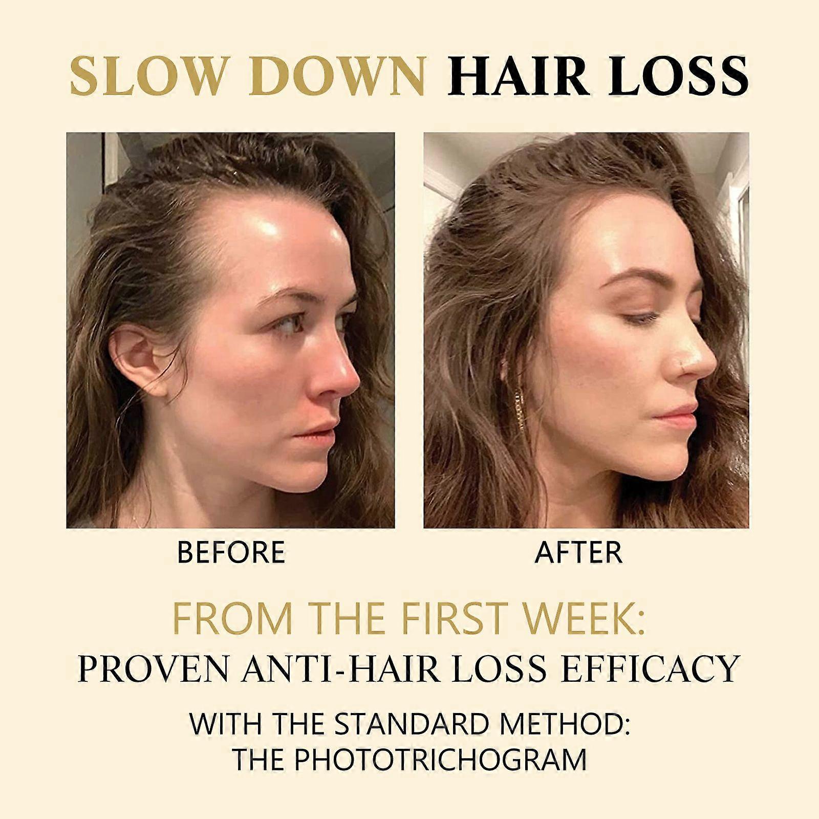 Hair Boost Darken Strengthen Essence, Scalp Massage Moisturizing Hair ...