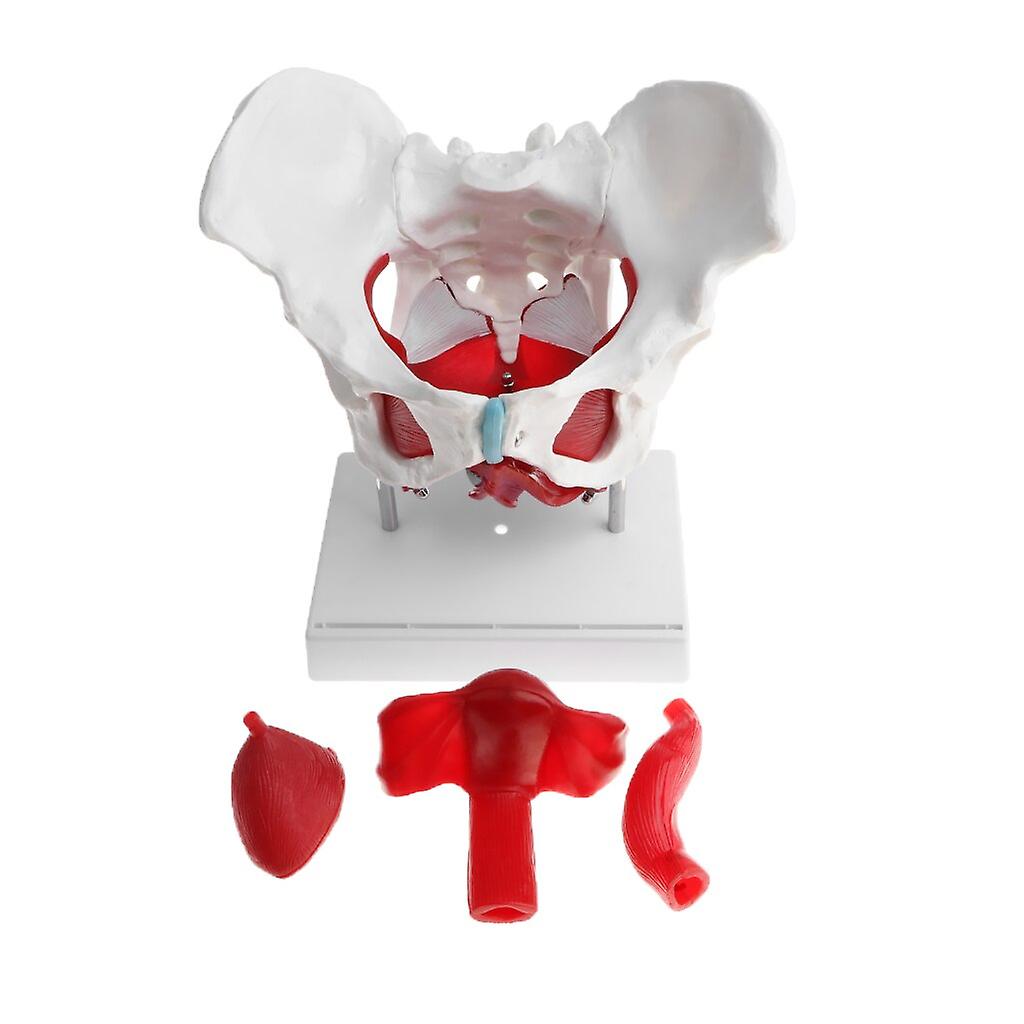 1:1 Pathological Changes Woman Skeleton Model Anatomical Female Pelvis ...