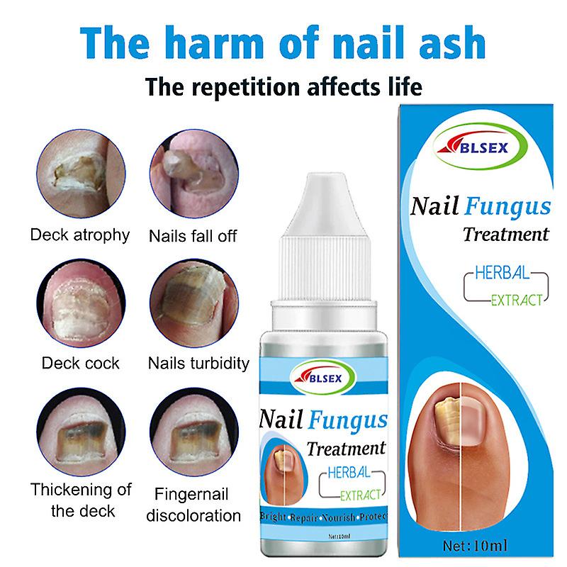 Fungus Nails Treatment For Fingernails Toenails Repair Onychomycosis ...