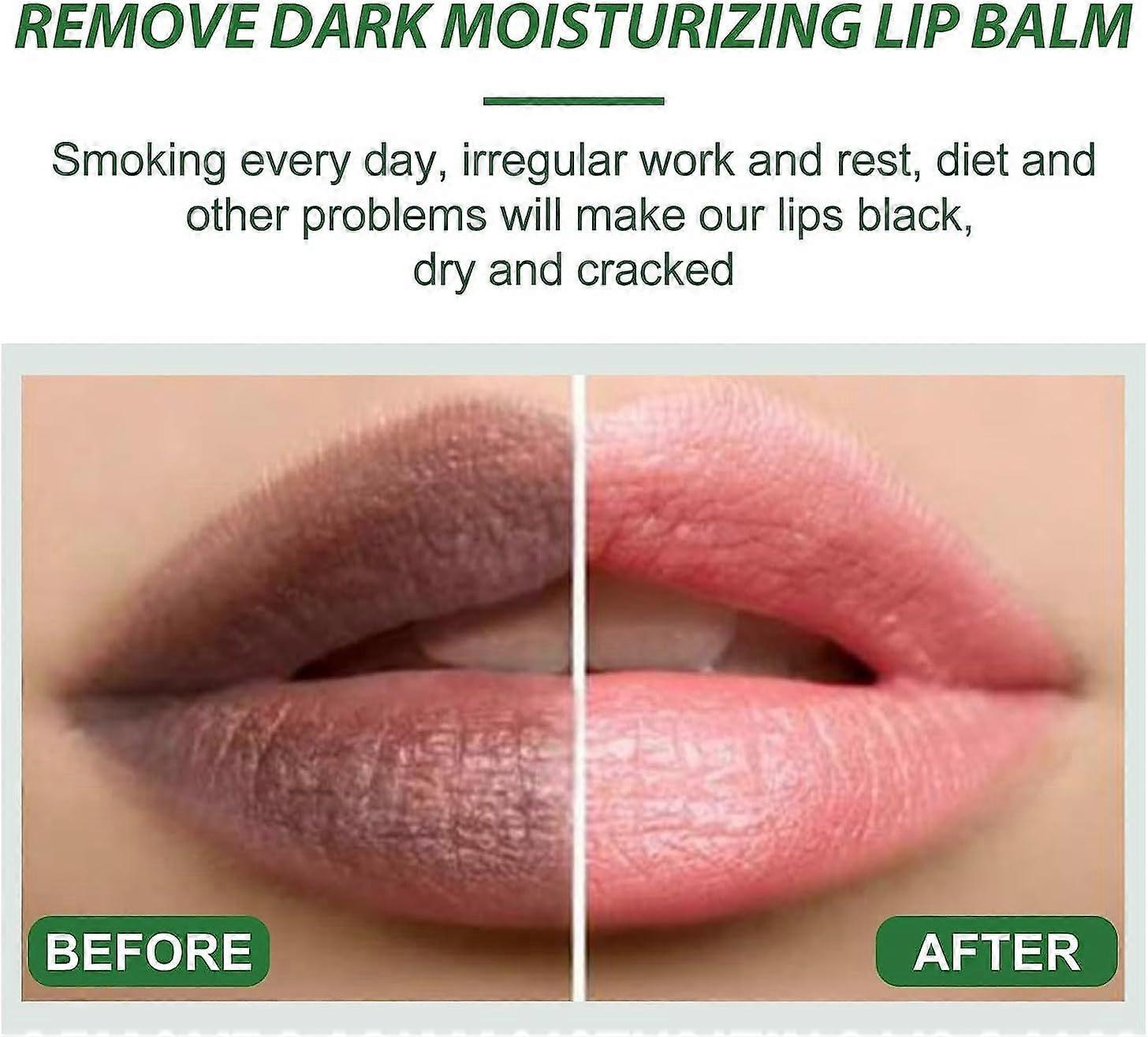 New Lips Pink Fresh Lightening Bleaching Cream Treatment Remove Dark ...