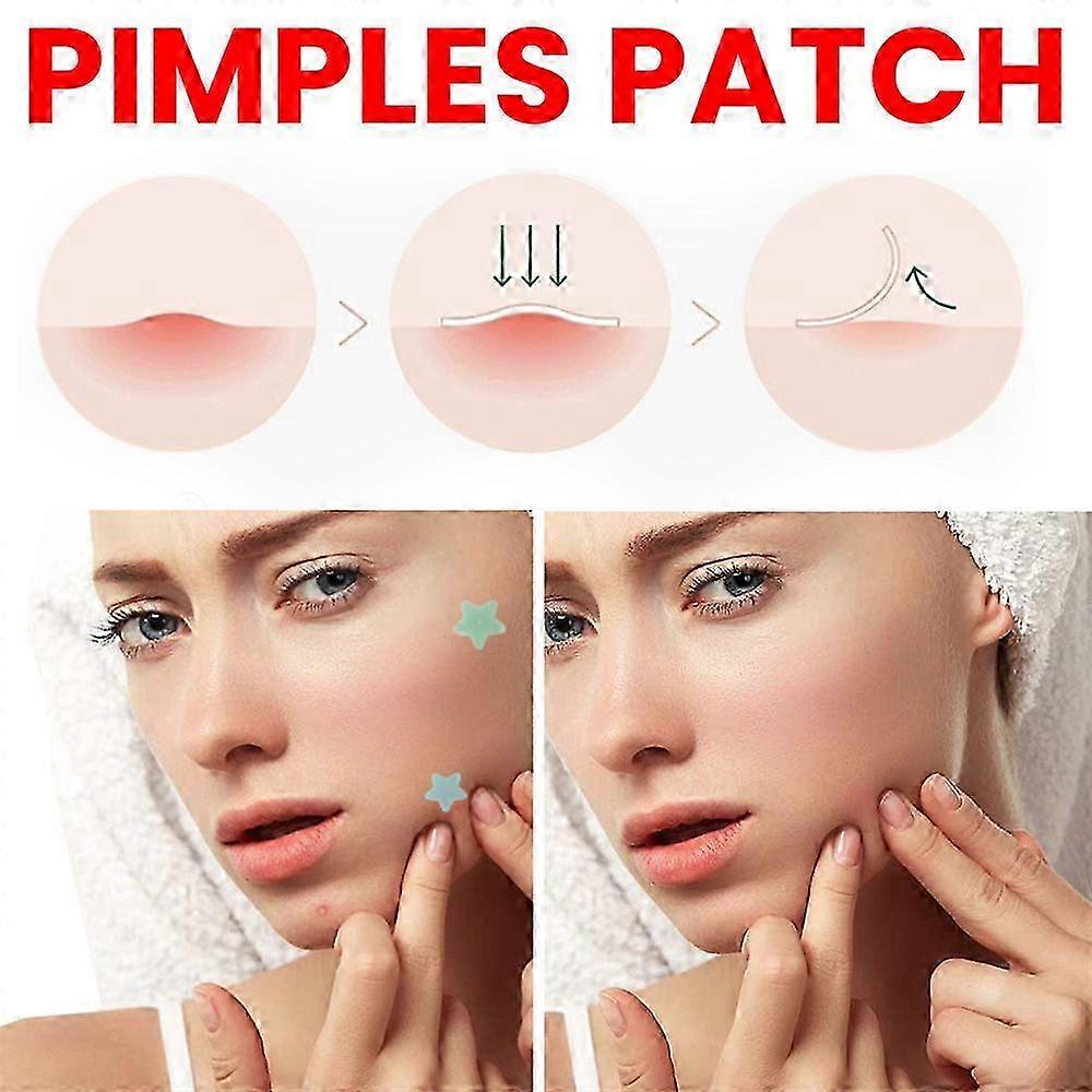 Pimple Patches for Face Hydrocolloid Acne Patches Versitile Cute Star ...