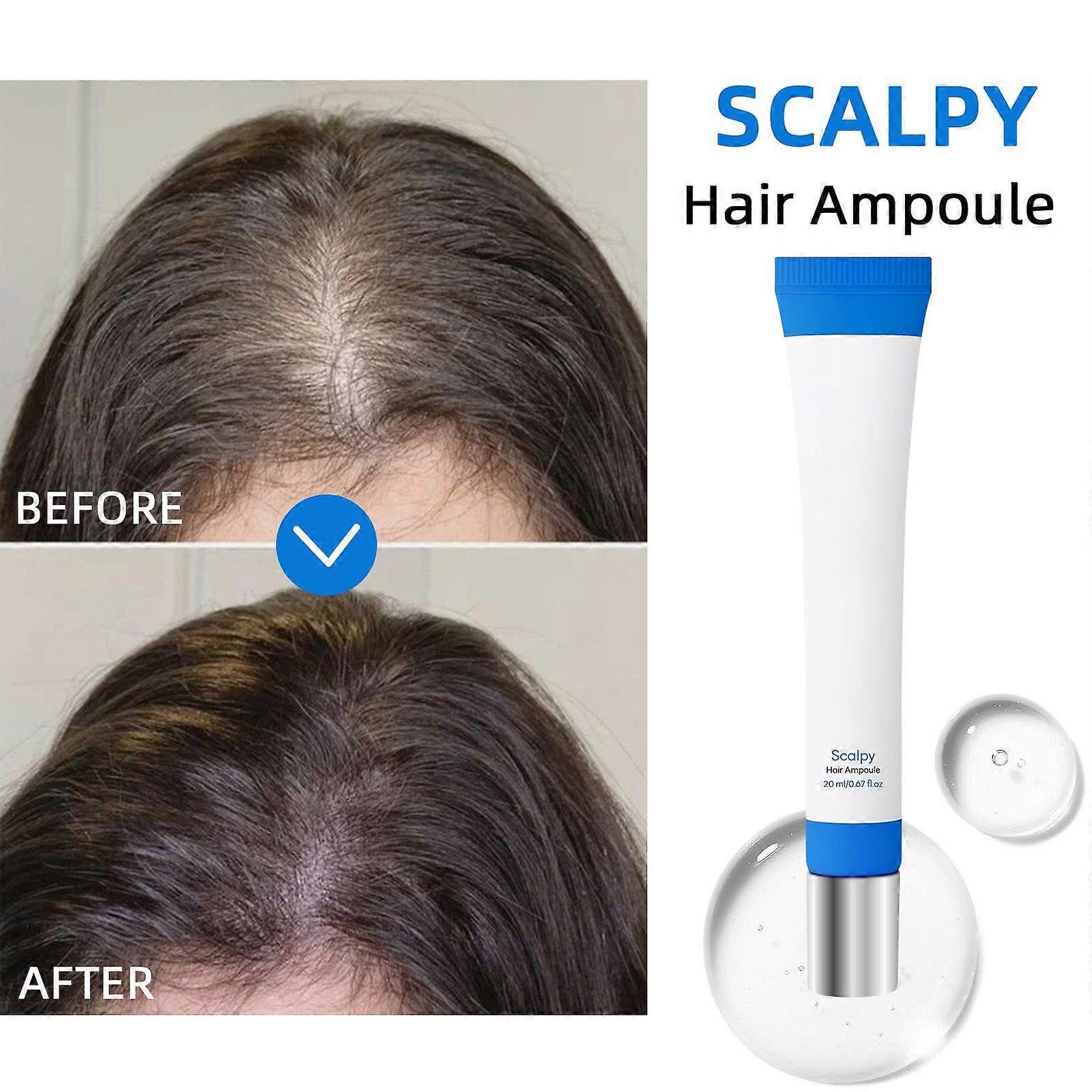 Scalpy Hair Growth Serum for Men & Women for Hair Loss & Thinning ...