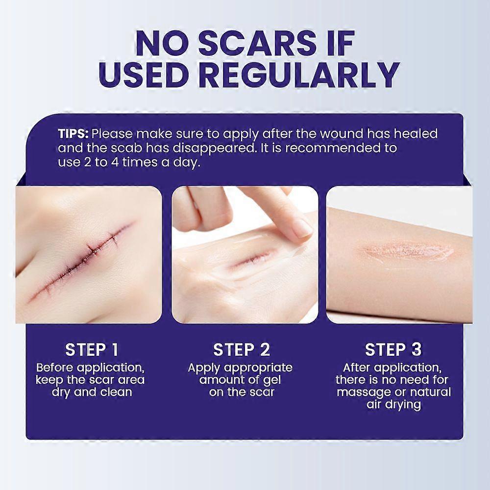 Advanced Scar Gel, Keloid Bump Removal, Scar Cream, Scar Removal Cream ...