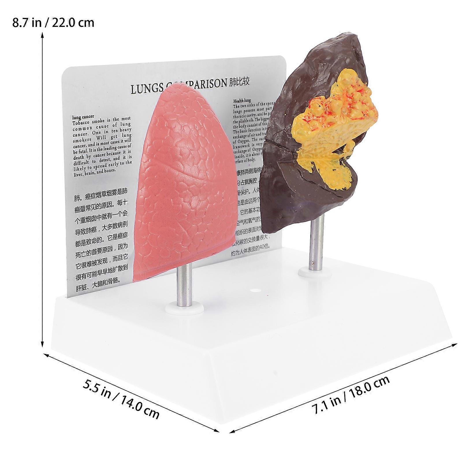 Molds Comparison Model Lung Function Demonstration Model Human ...