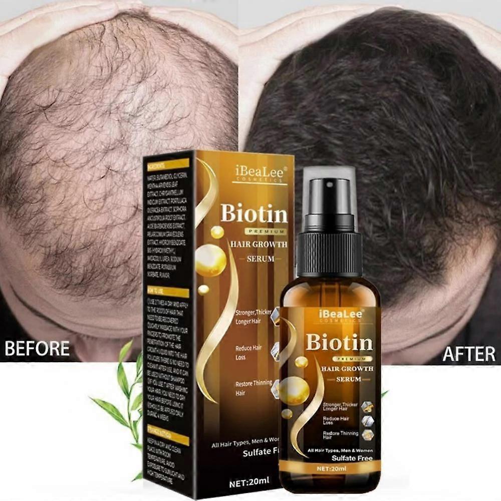 Hair Growth Products Biotin Hair Oil Fast Regrowth Anti-Hair Loss Serum Thickener Scalp ...