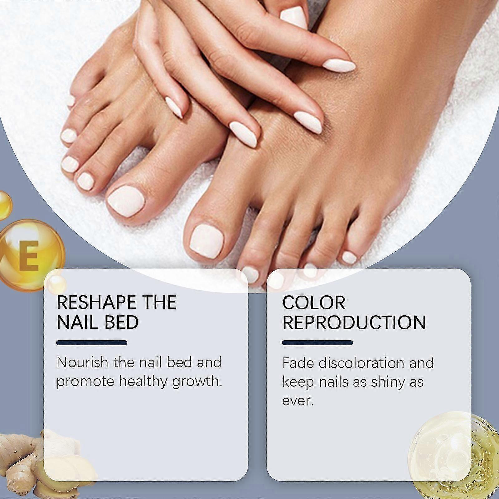 Anti-Fungal Toenail Cream, Nail Care Anti-Fungal Cream, Fungal Nail ...