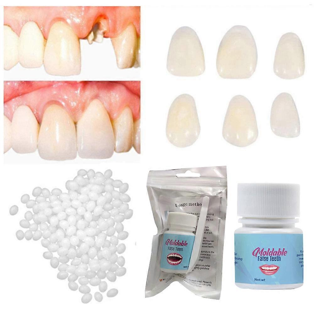 20g Dental Resin Shapeable Teeth Glue Temporary Filling Teeth Repair ...