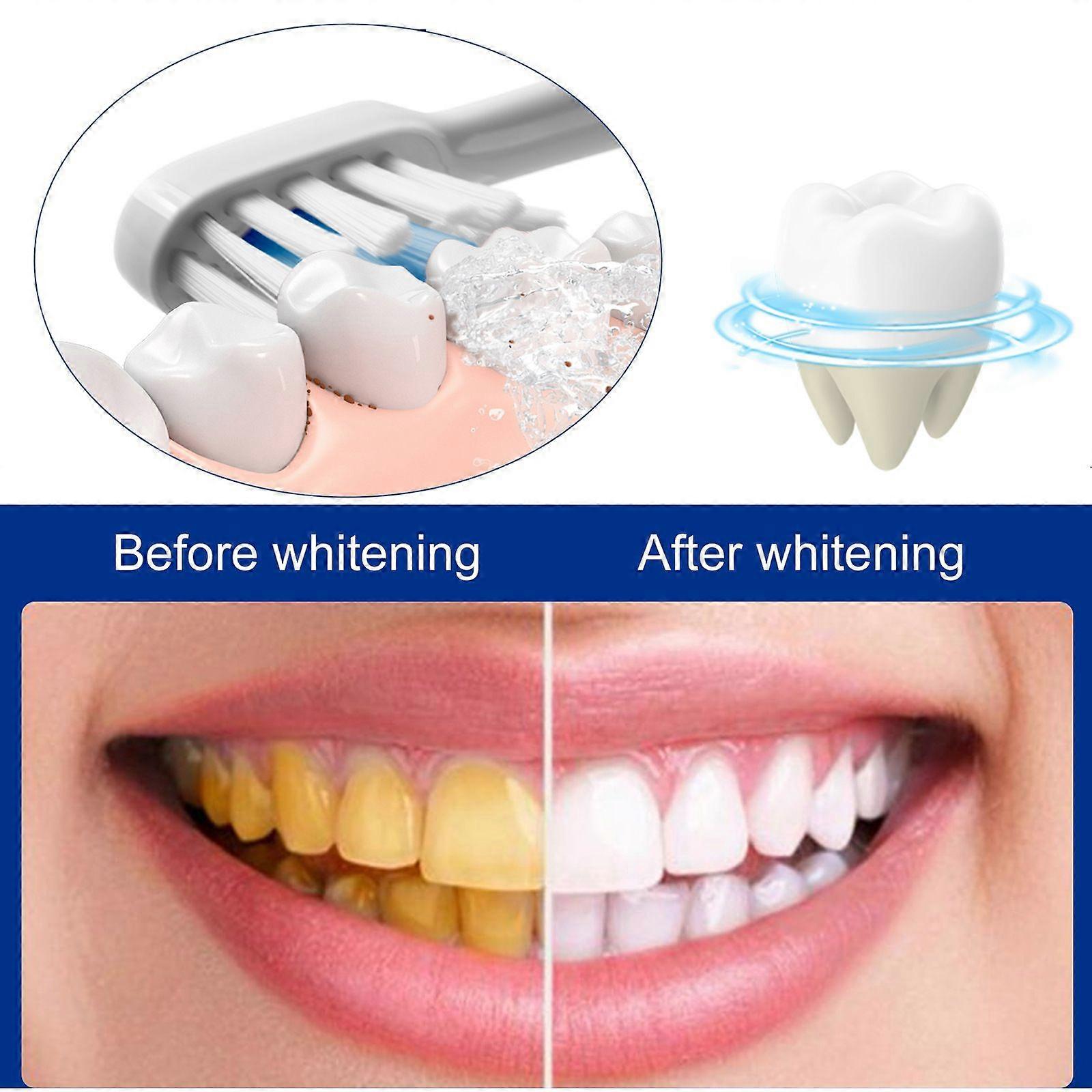 Repair Toothpaste, White Teeth Clean Stains And Tartar Yellow Mouth ...