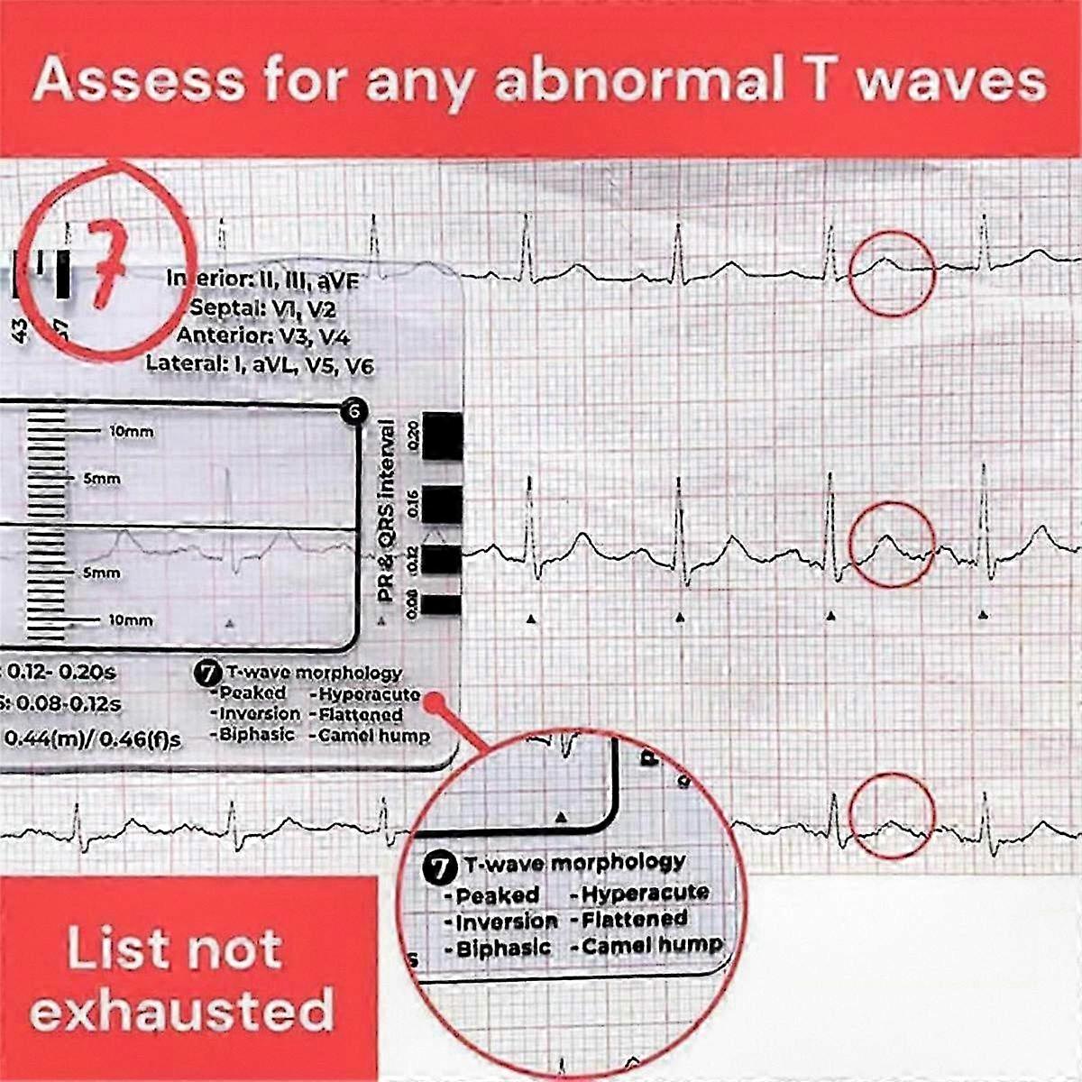 2pcs ECG 7 Step Measuring Guide, ECG Interpretation Tool for Medical Professionals, Heart Rate ...