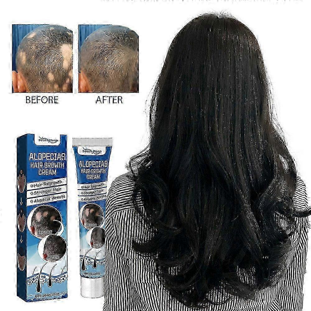 1-3x nya alopeci behandling kräm hår växer förhindra alopeci skallighet ...