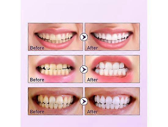 Purple Whitening Tooth Powder, Tooth Cleaning Powder, Powerful Tooth ...