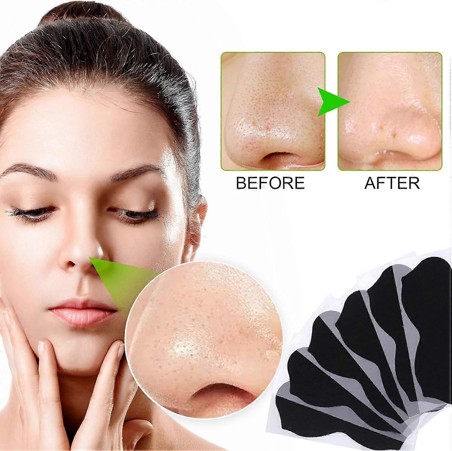 80 Pcs Blackhead Remover Strips Bamboo Charcoal Deep Cleansing Pore ...