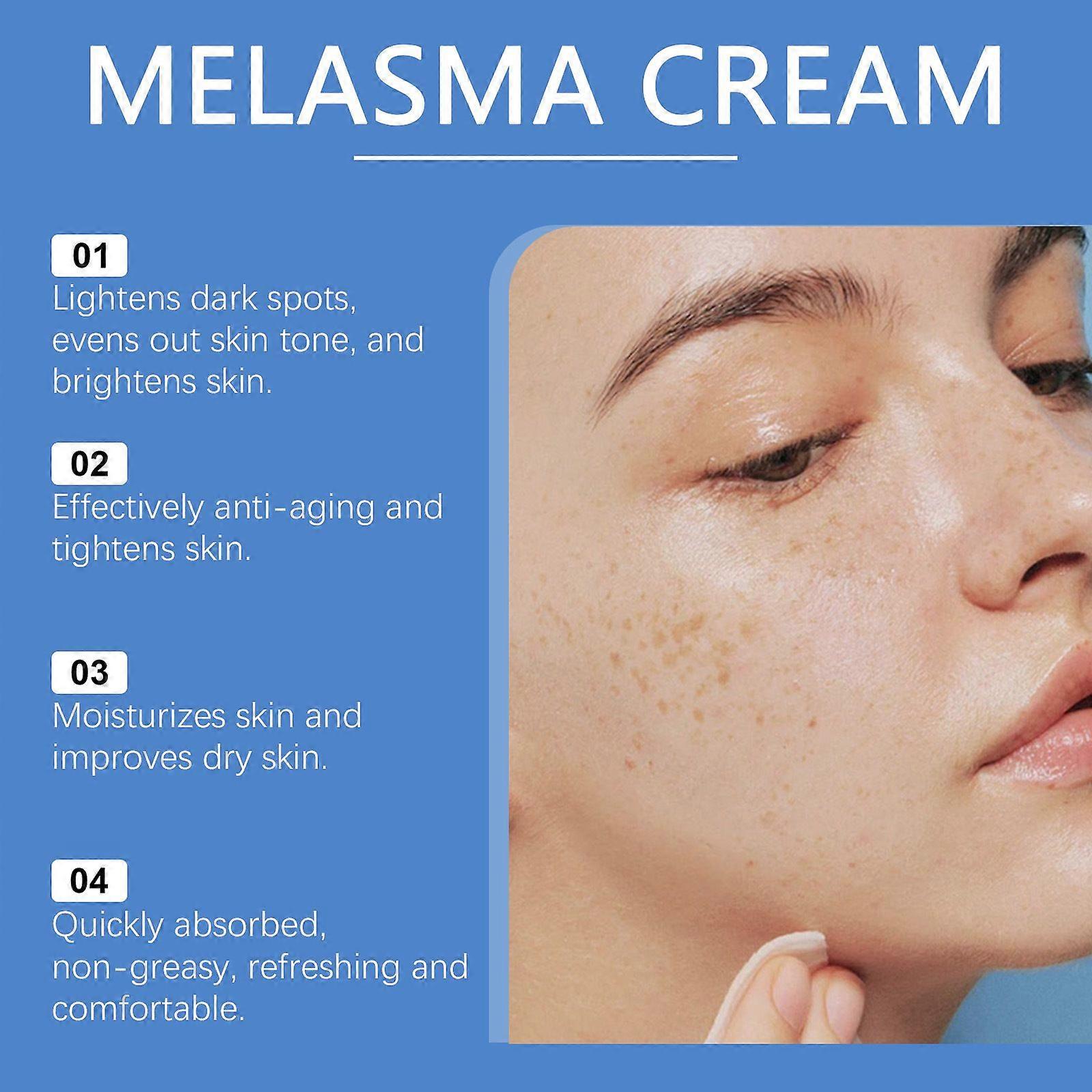 Melasma Cream, Cream for Face Treatment, Summer Spot Weighted Cream ...