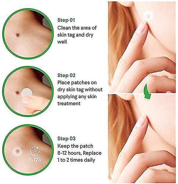 72pcs Skin Tag Remover Wratten Remover Patch Wart Behandeling Kruidenextract Gezicht Corn ...