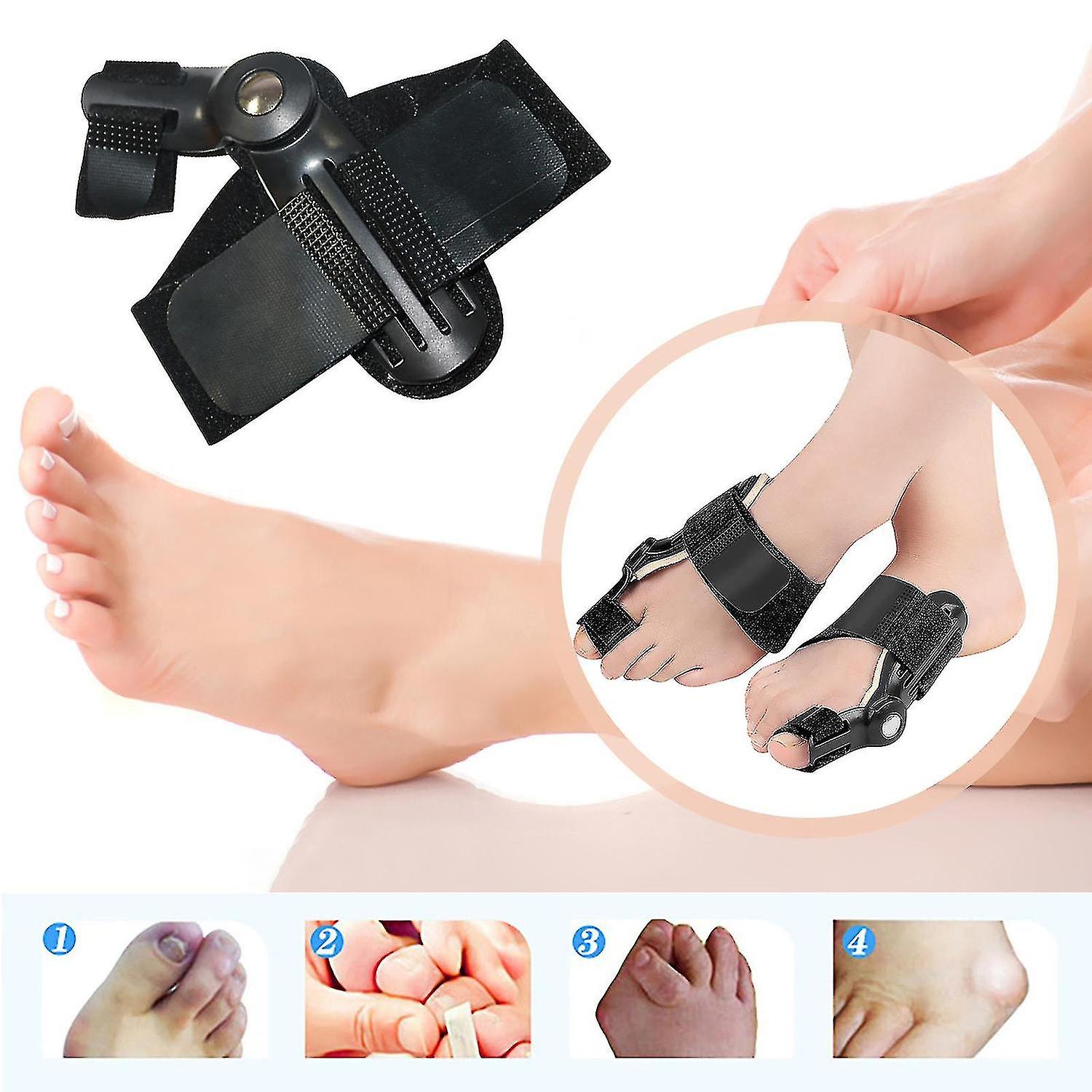 Hallux Valgus Splint Valgus Correction Hallux Valgus Toe Separator ...