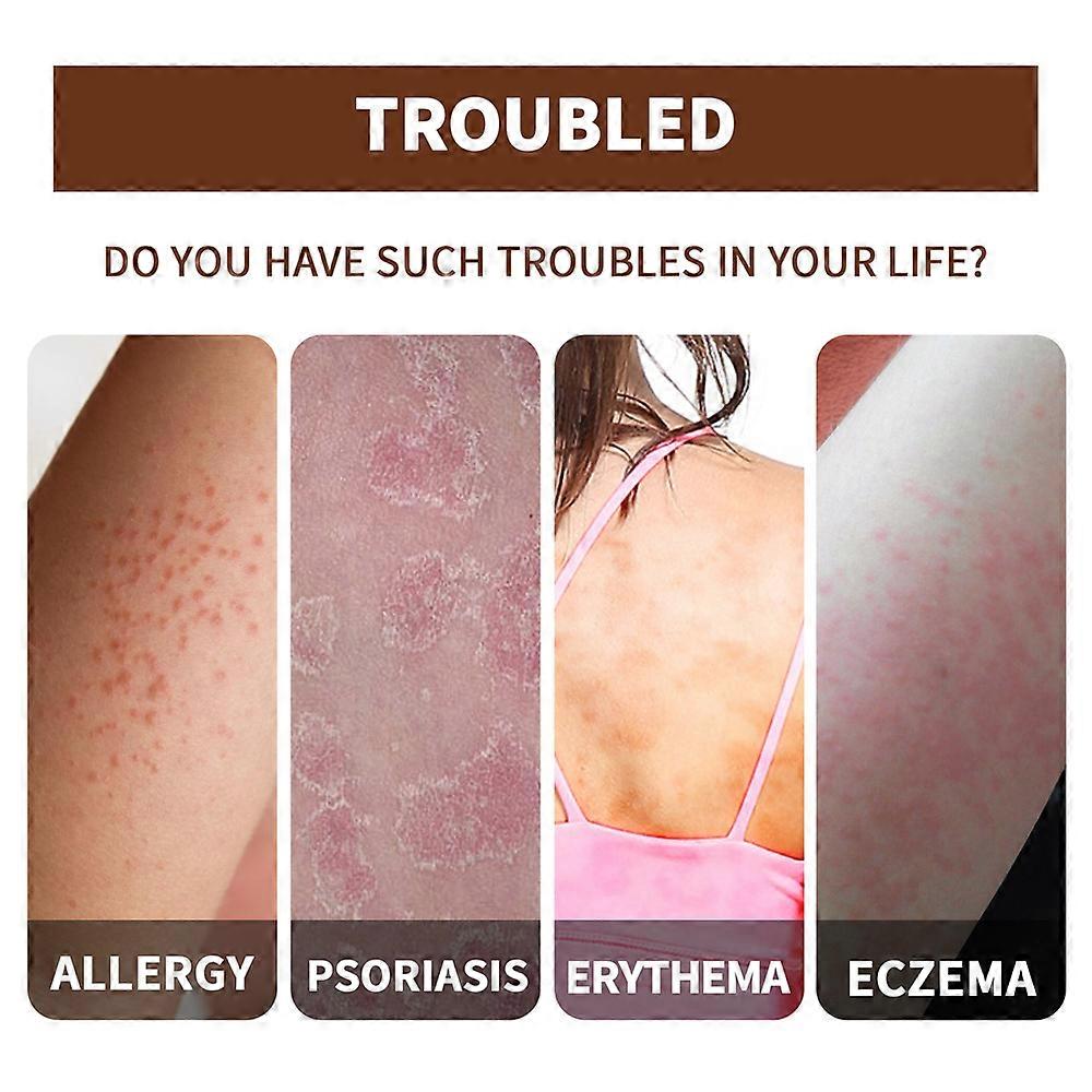 Skin psoriasis repair essential oil Anti itch swelling hand foot ...