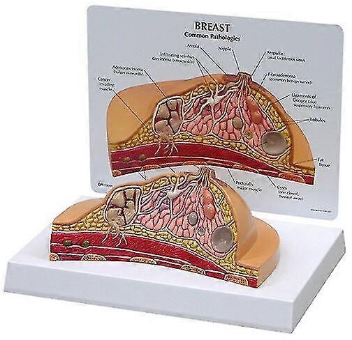 Breast disease breast anatomy model human body model anatomical human ...