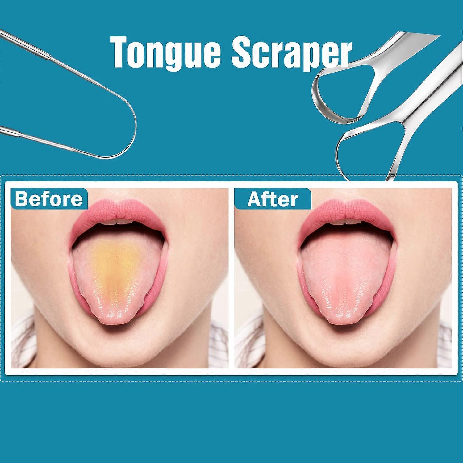 3 PCS Metal Tongue Scraper, Tongue Scrapers for Adults, Stainless Steel ...