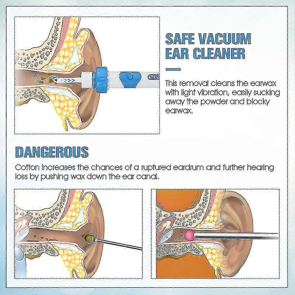 Electric Ear Wax Vacuum Remover Kit Earwax Removal Cleaner Safe Ear ...