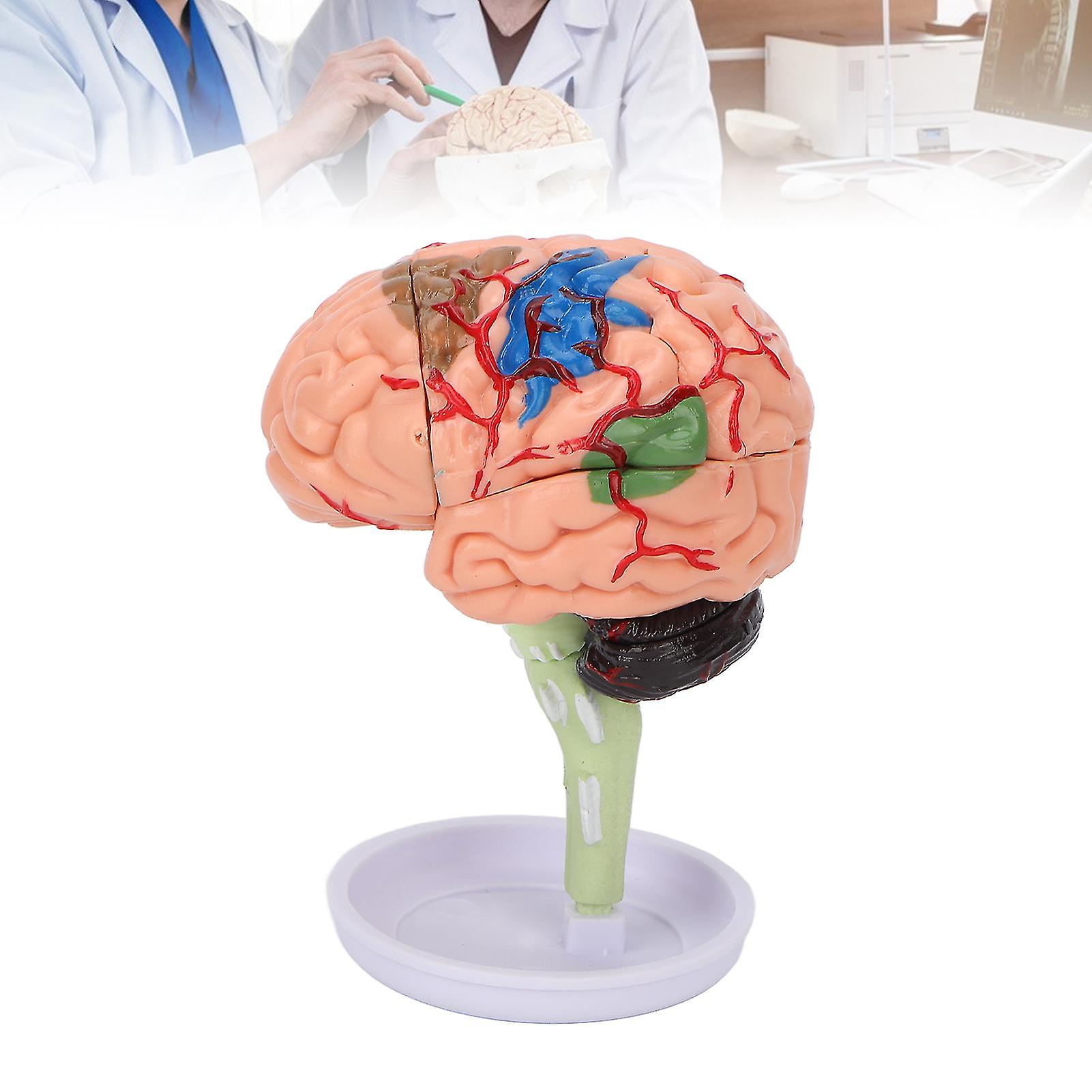 2024 New,4d Anatomical Brain Assembled Model Clear Structure Vinyl ...