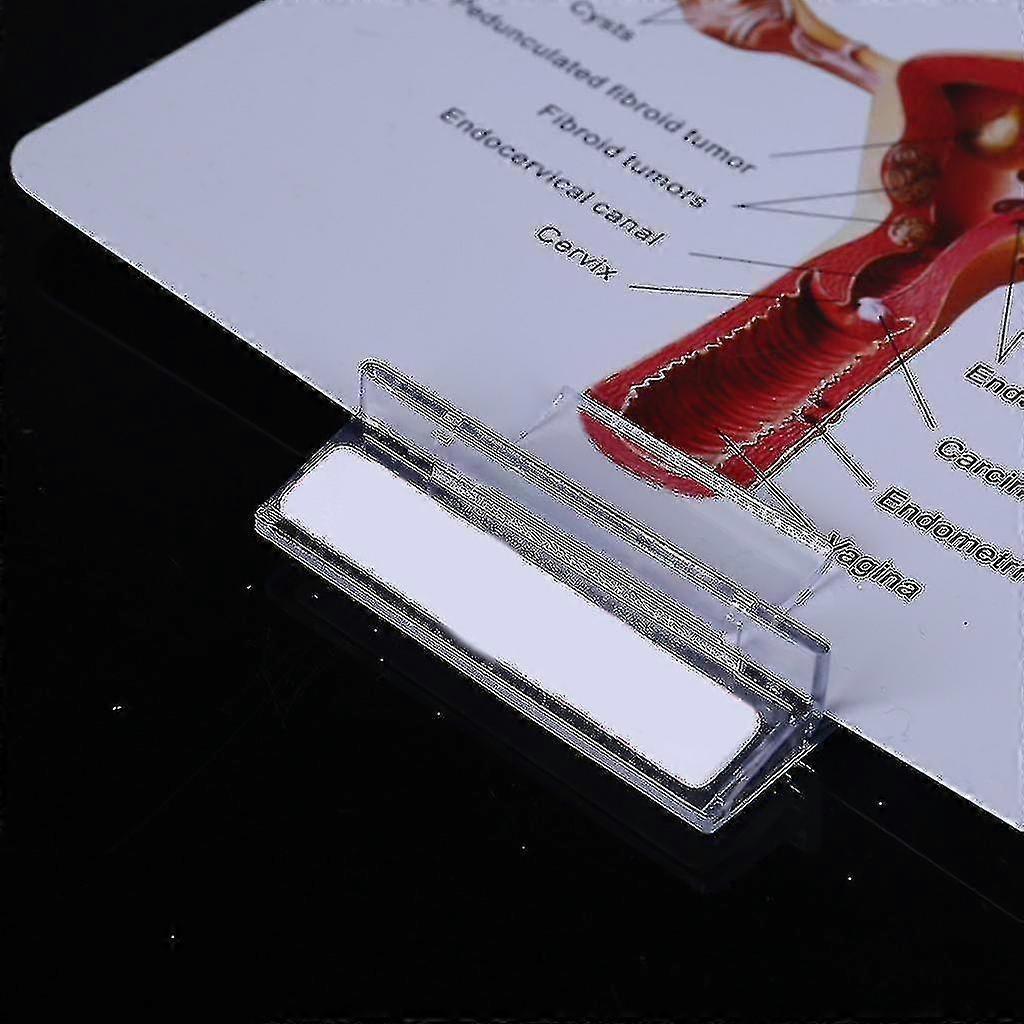 High Female Uterus Ovary Dissection Pathology Biology Teaching Anatomy ...