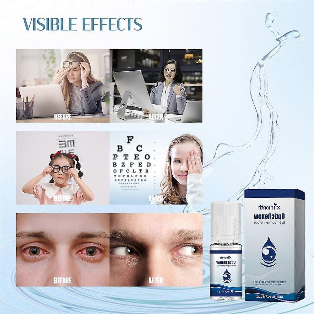 1-3X Eyesight Improvement High Quality Eye Drops Relieve Blurred Vision ...