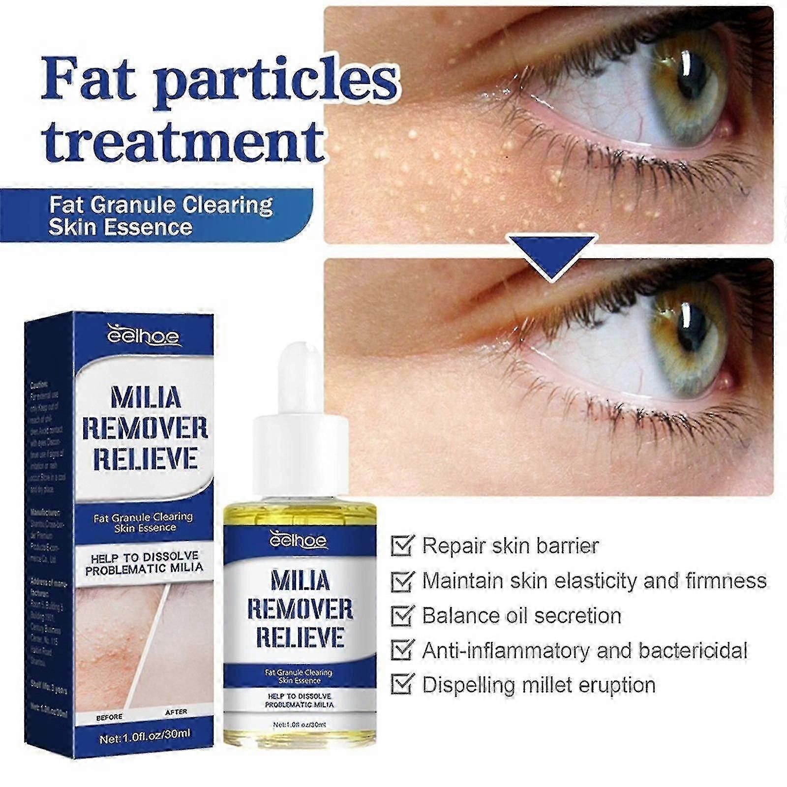Milia Remover, Milia For Eye, Milia, Sebaceous 30ml | Fruugo UK