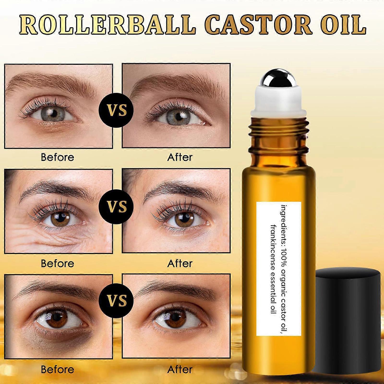 10ml Castor Oil Eye Roller: Eliminate dark circles and tighten skin ...