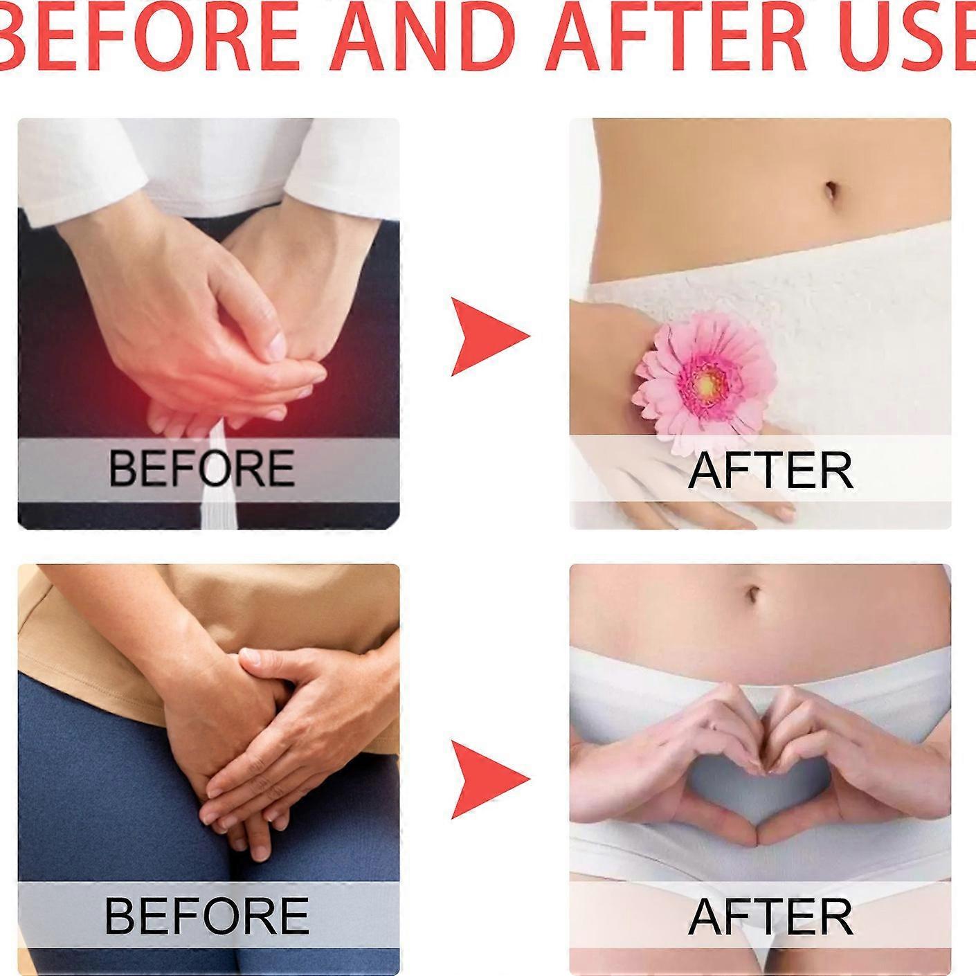 Itching Relief For Intimate Parts, Anti-Itch Cream For Women, Soothing And Refreshing Cream For ...