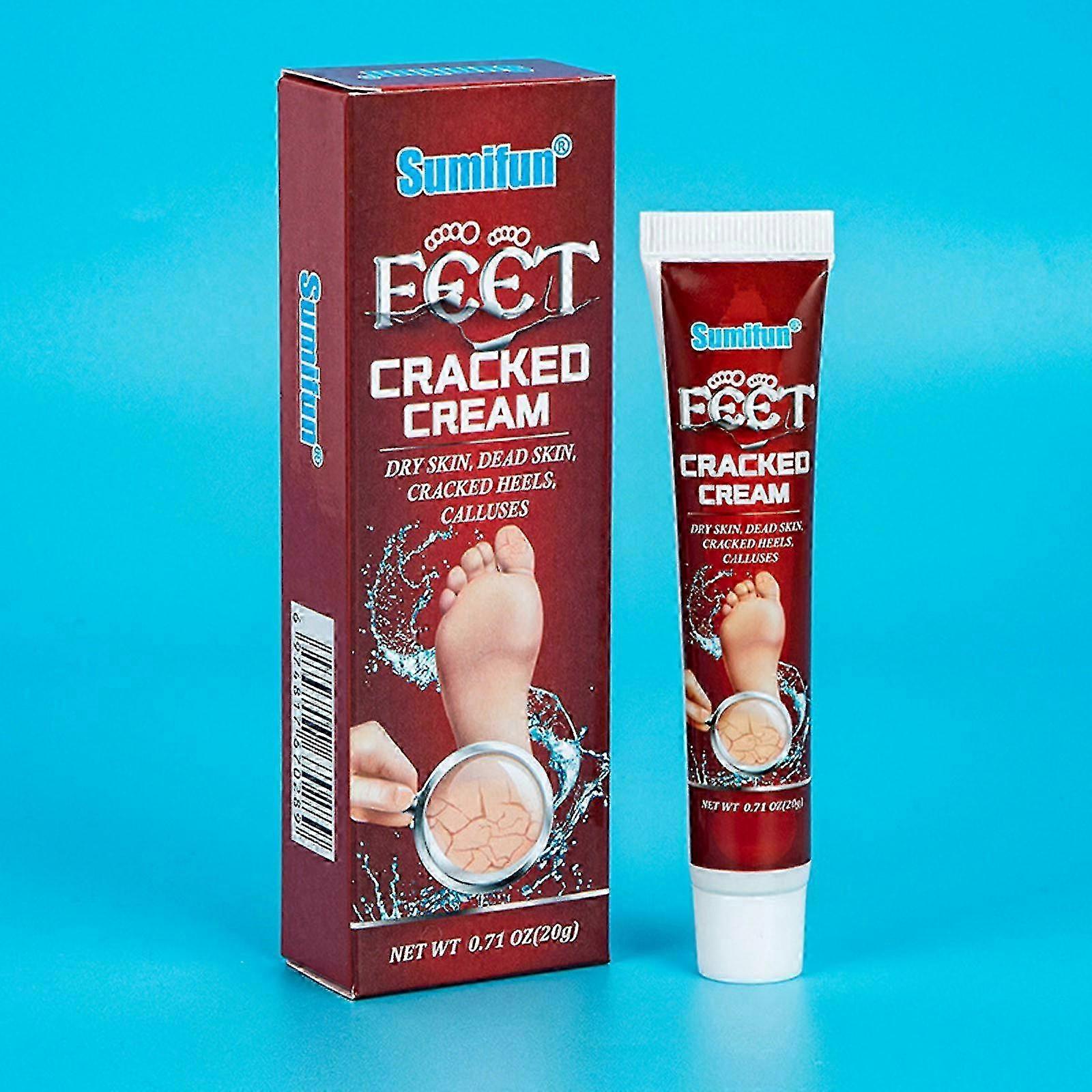 Cracked Hands And Feet Cream Dry Crack Anti-freeze Crack Crack Crack ...